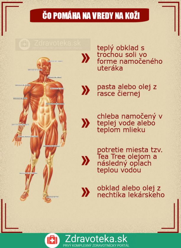 Vred: Prečo vznikajú zle hojace vredy? (kožné vredy i v tele) - príznak ...