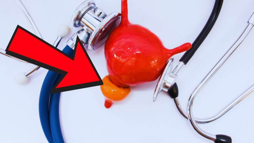 Zväčšená prostata: BHP benígna hyperplázia prostaty a jej príčiny ...